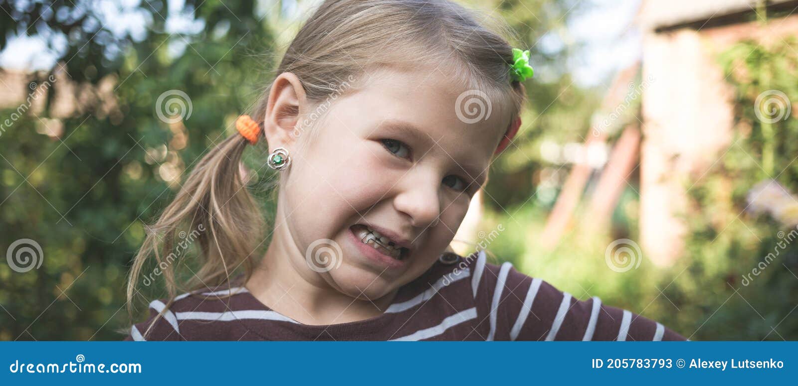 Child with a Dental Orthodontic Device and without One Tooth Stock ...
