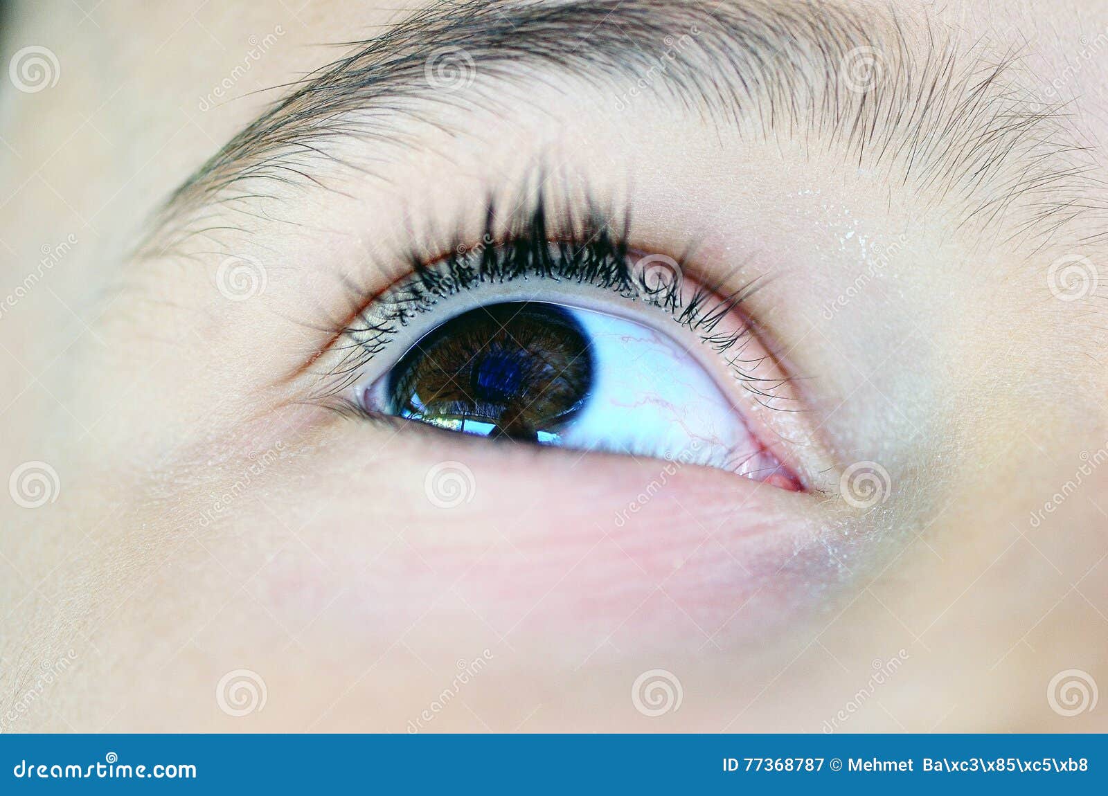 Child eye stock image. Image of blood, closeup, eyehole - 77368787