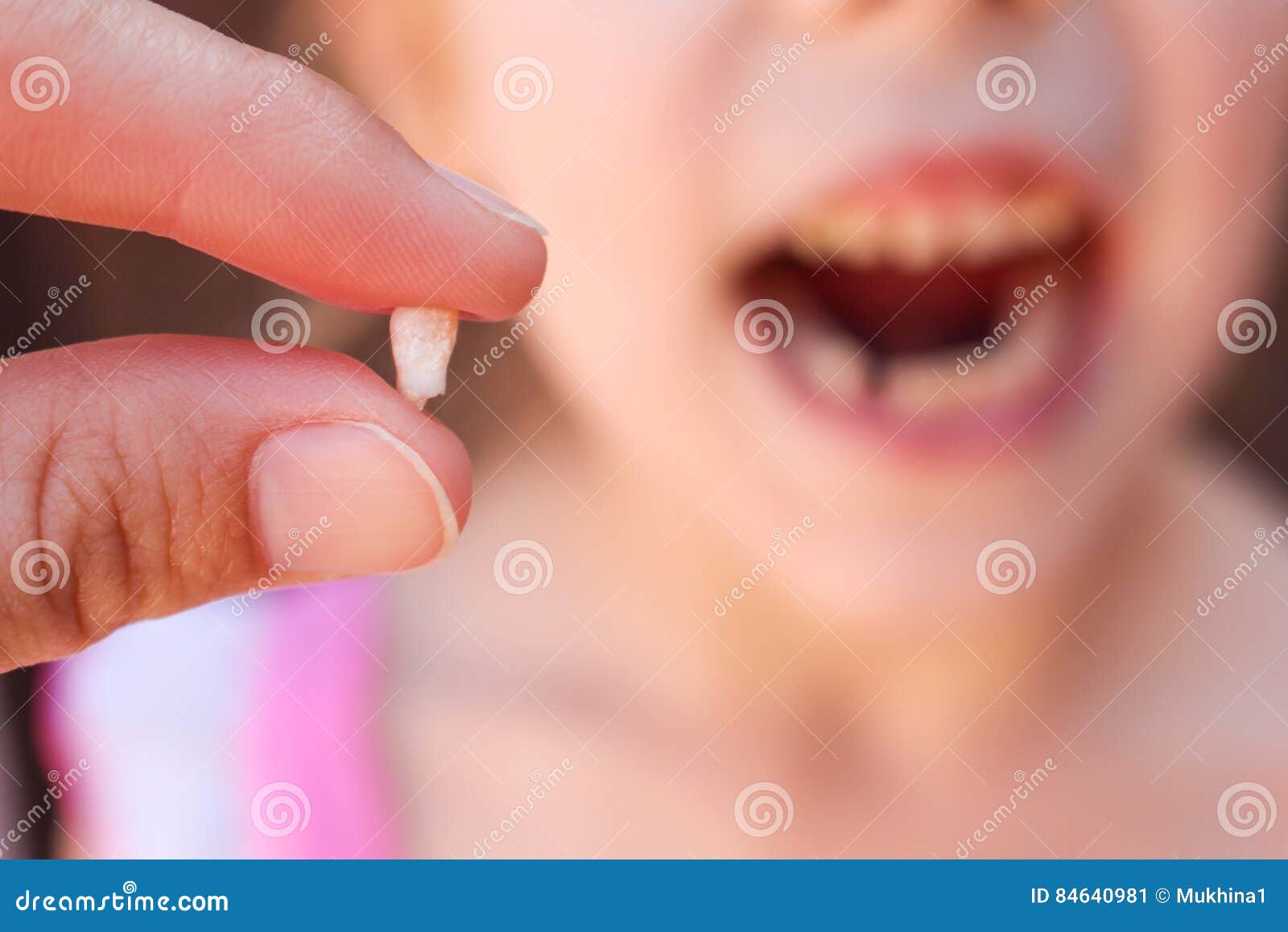 Child has lost baby tooth. stock image. Image of clear - 84640981
