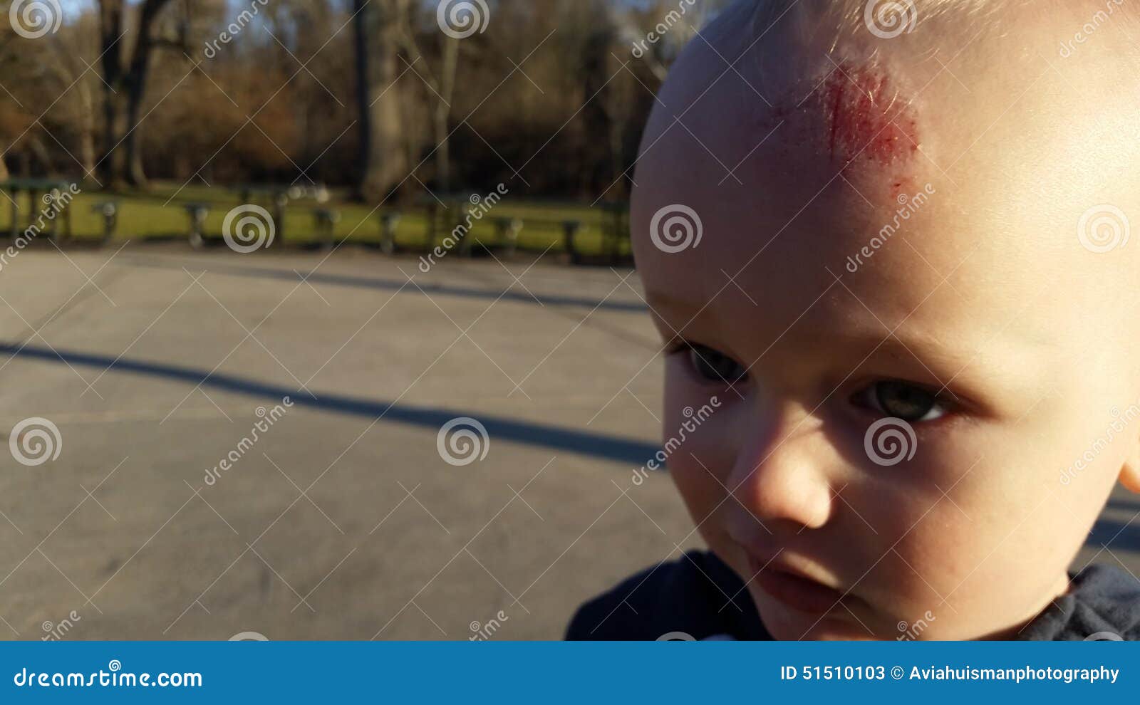 Child with Head Injury stock image. Image of care, good - 51510103