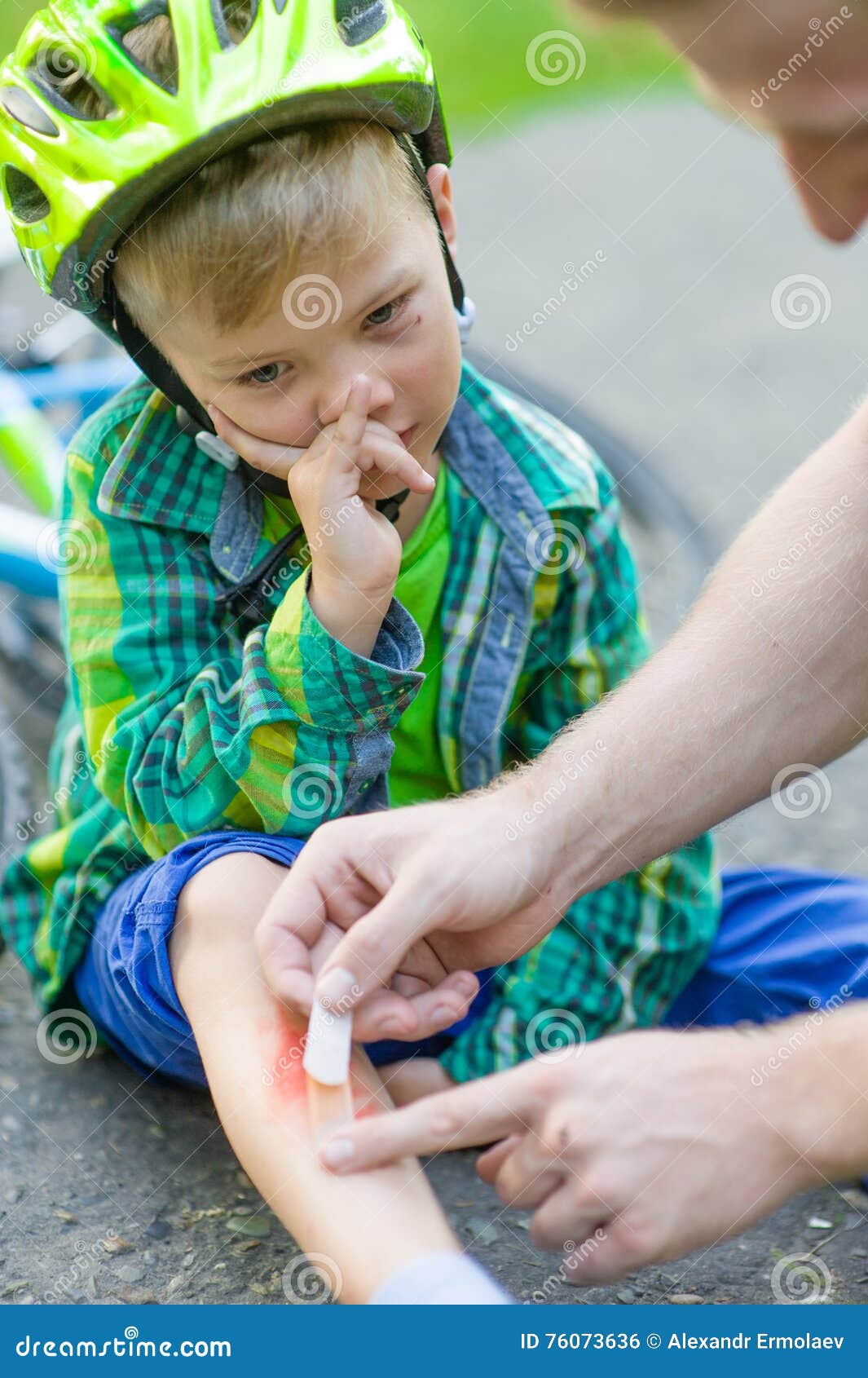 Child with an Injury from a Fall from a Bicycle Stock Photo - Image of ...