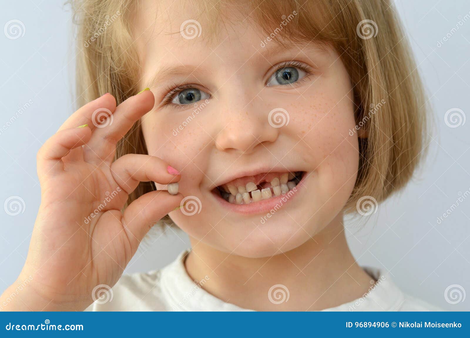 Child, Kid, Shows the Fallen Baby Tooth. Stock Photo - Image of doctor ...