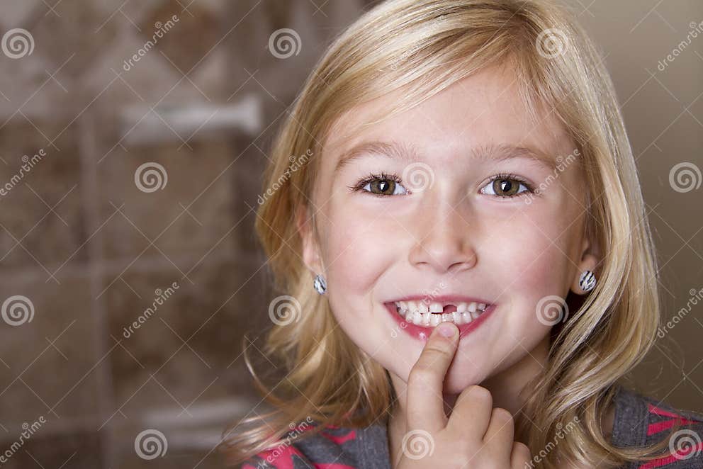 Child missing front tooth stock image. Image of care - 45432907