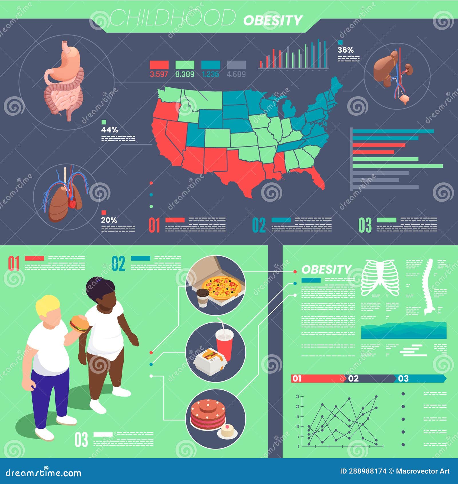 Child Obesity Infographic Set Stock Vector - Illustration of problem ...