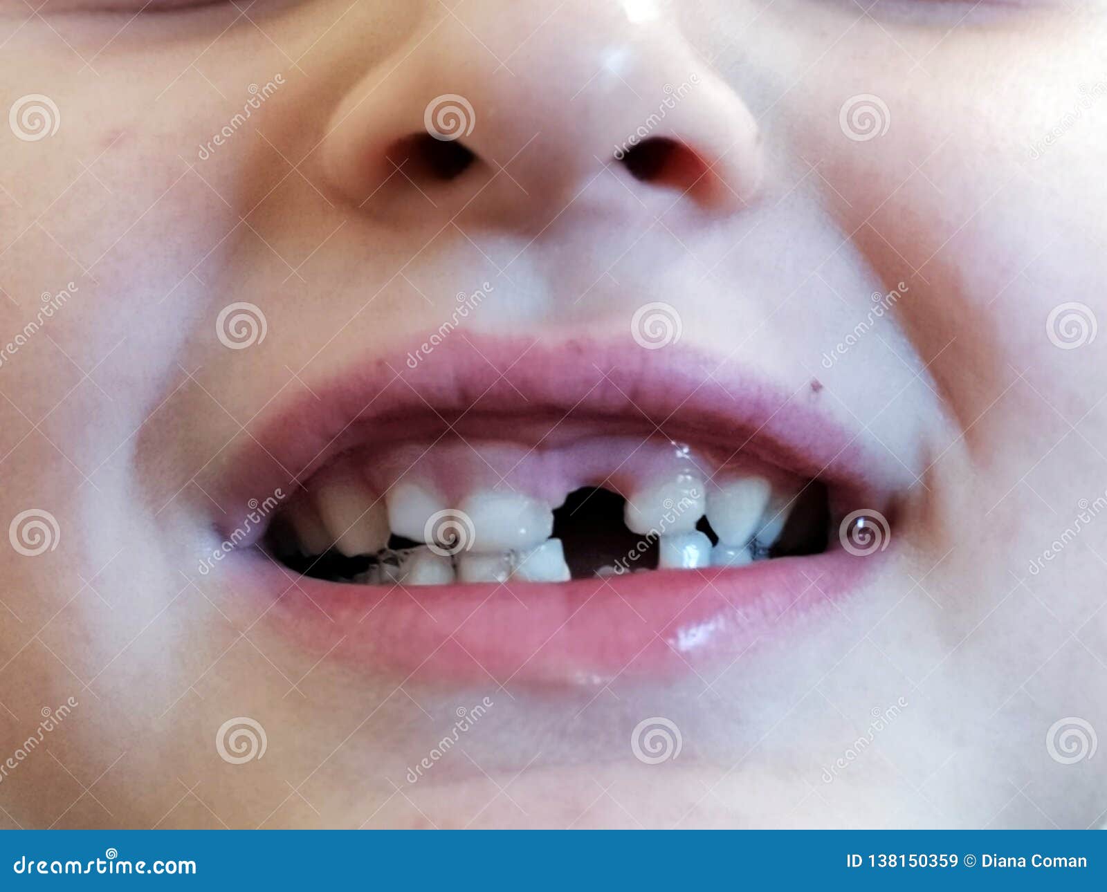 Child Proud of Missing Front Tooth Stock Image - Image of milk, child ...