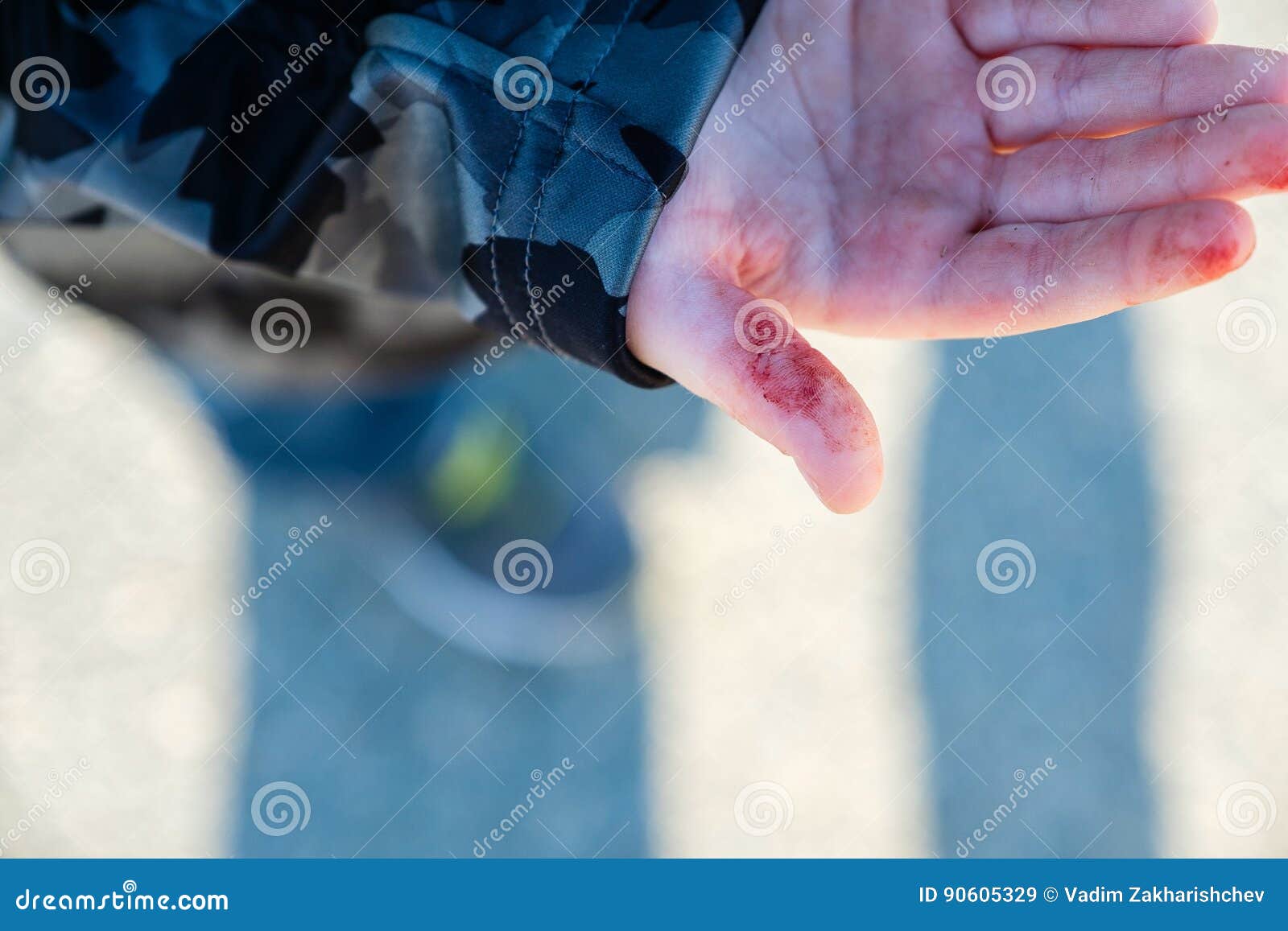 The Child`s Finger Blood Cut or Wound Stock Image - Image of people ...