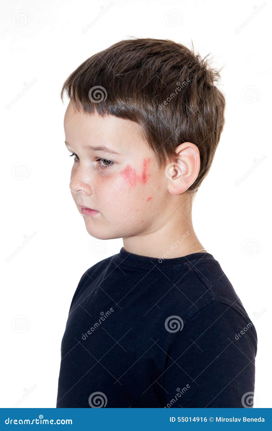 Child with a scraped face stock photo. Image of scab - 55014916