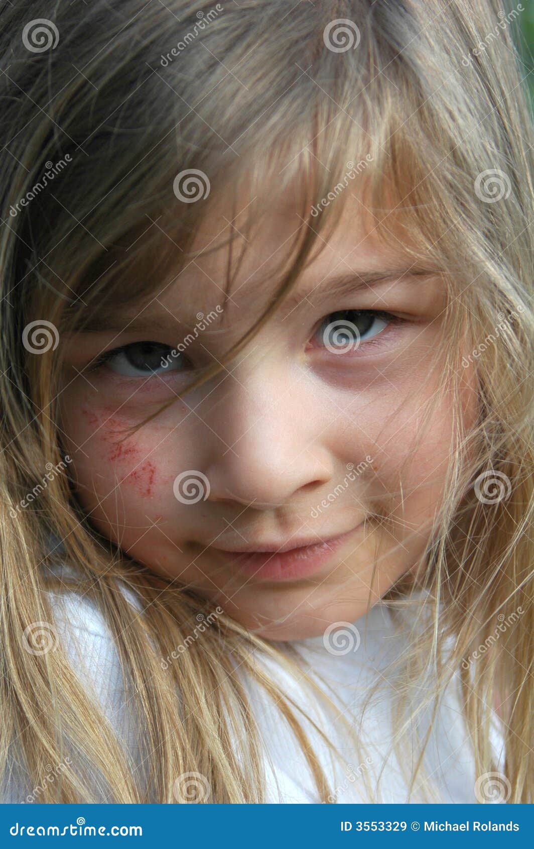 Child with scrapes stock image. Image of scrape, girl - 3553329