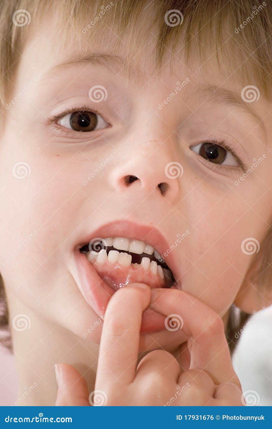 Child showing new tooth stock photo. Image of gums, teeth - 17931676