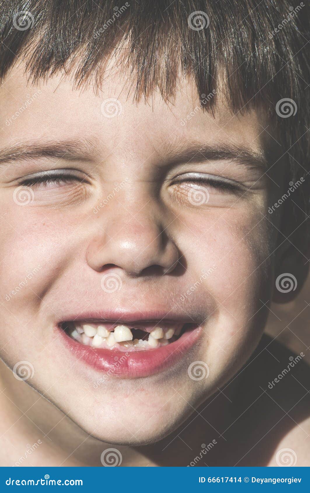 Child shows missing teeth stock photo. Image of front - 66617414