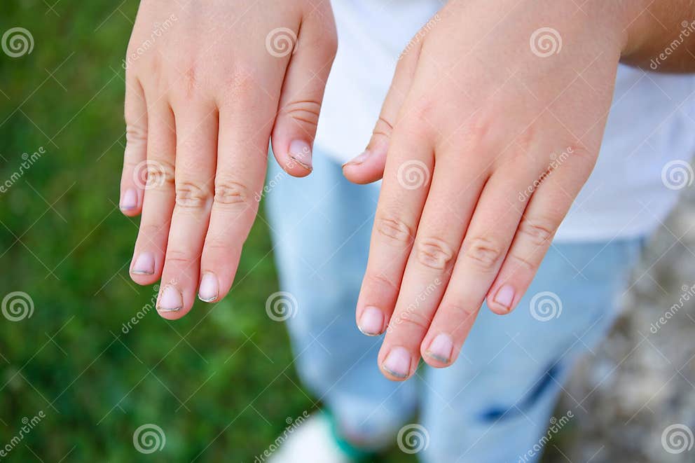 The Child Shows Nails in the Mud Stock Photo - Image of finger, outside ...