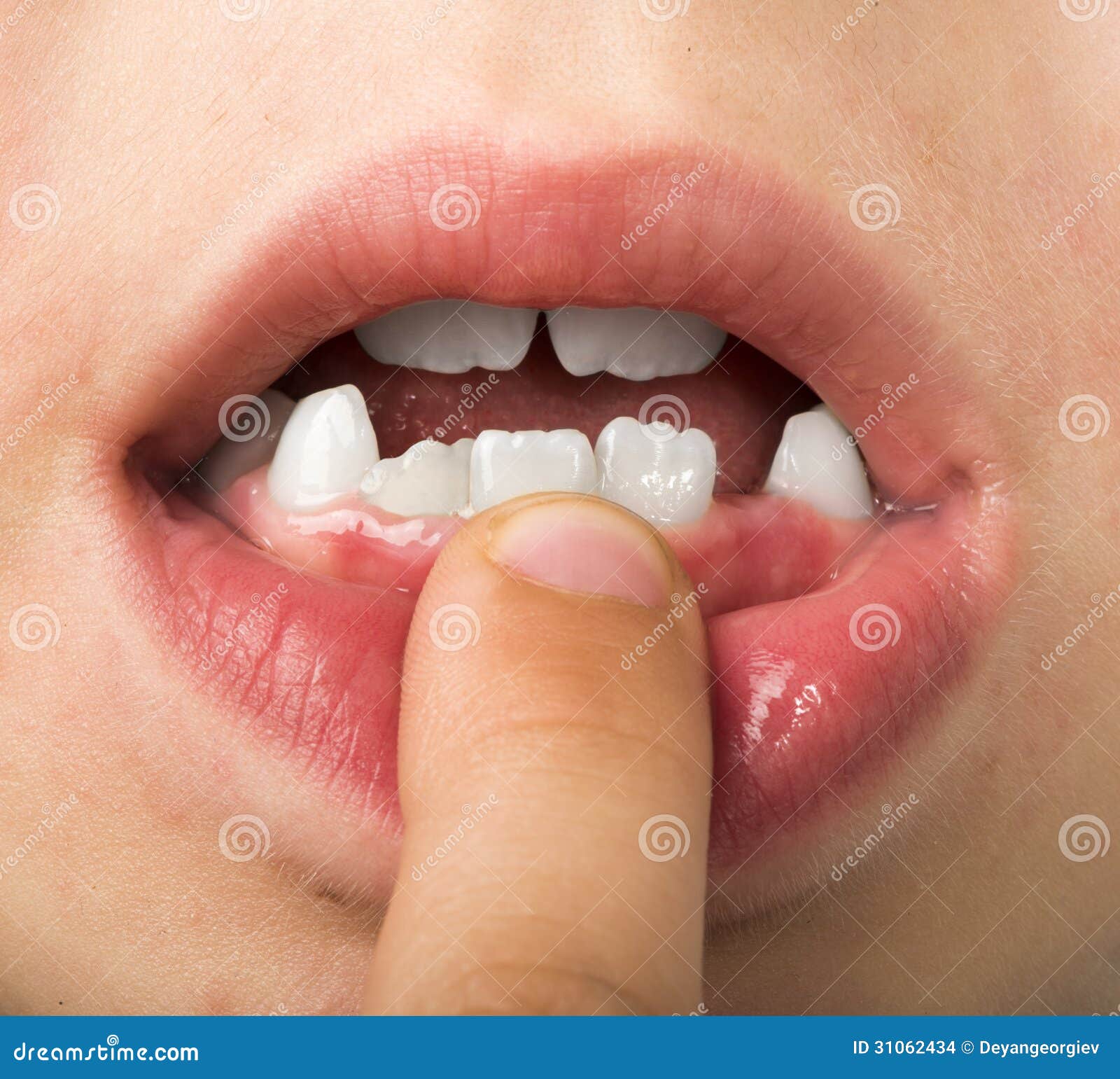 Child shows tooth stock photo. Image of smile, portrait - 31062434