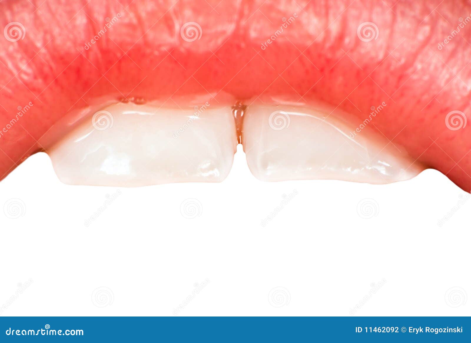 Child teeth stock photo. Image of bright, young, teeth - 11462092