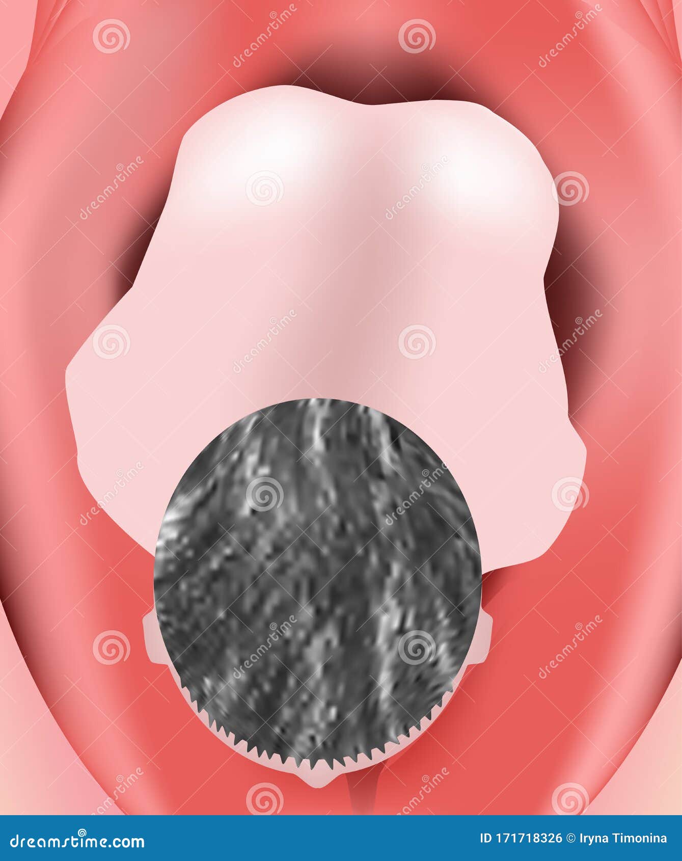 Childbirth. Baby Head Birth. Childbirth Illustration. Vector ...