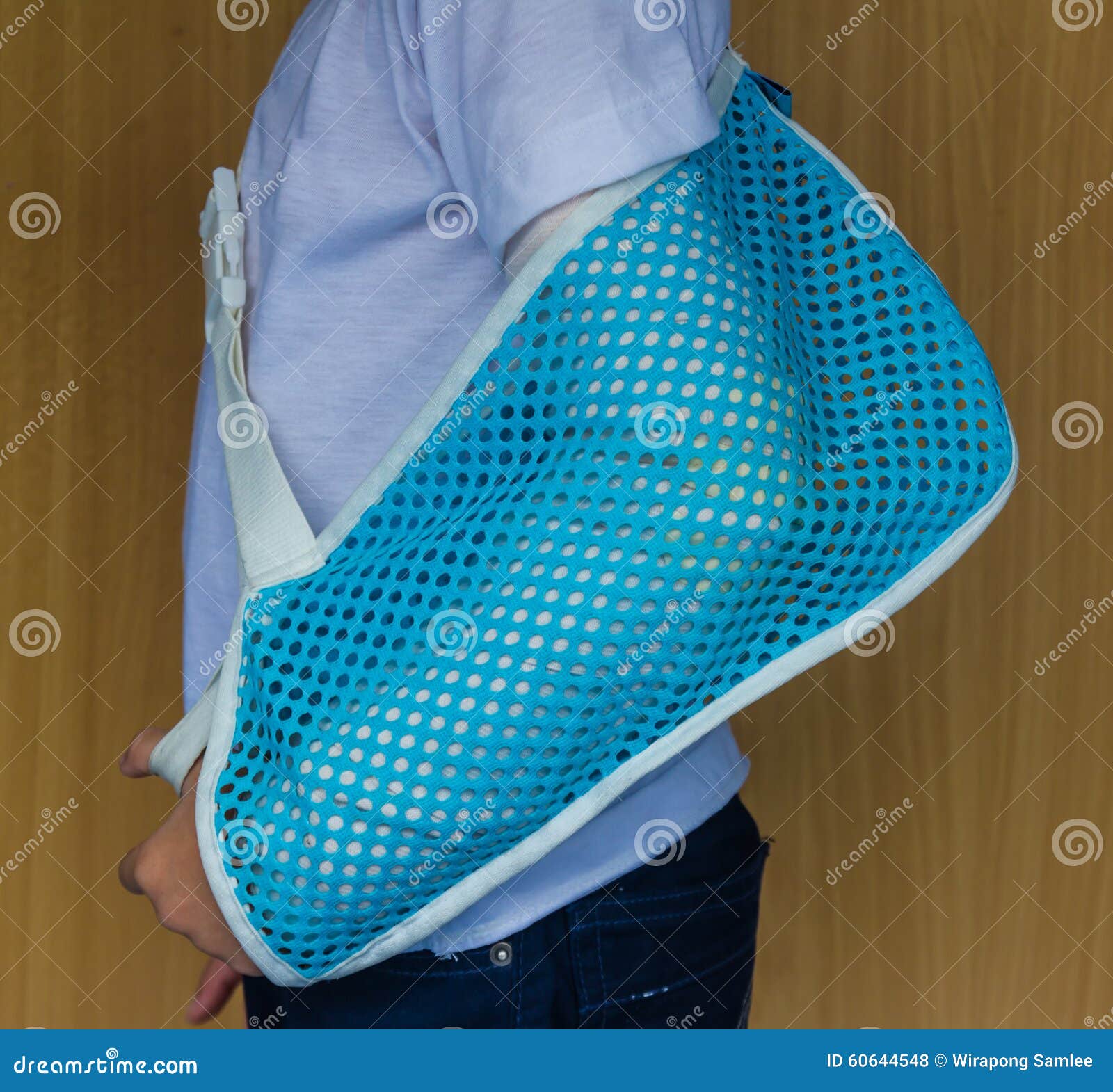 Children Arm Splint a Broken Stock Photo - Image of sore, bandage: 60644548
