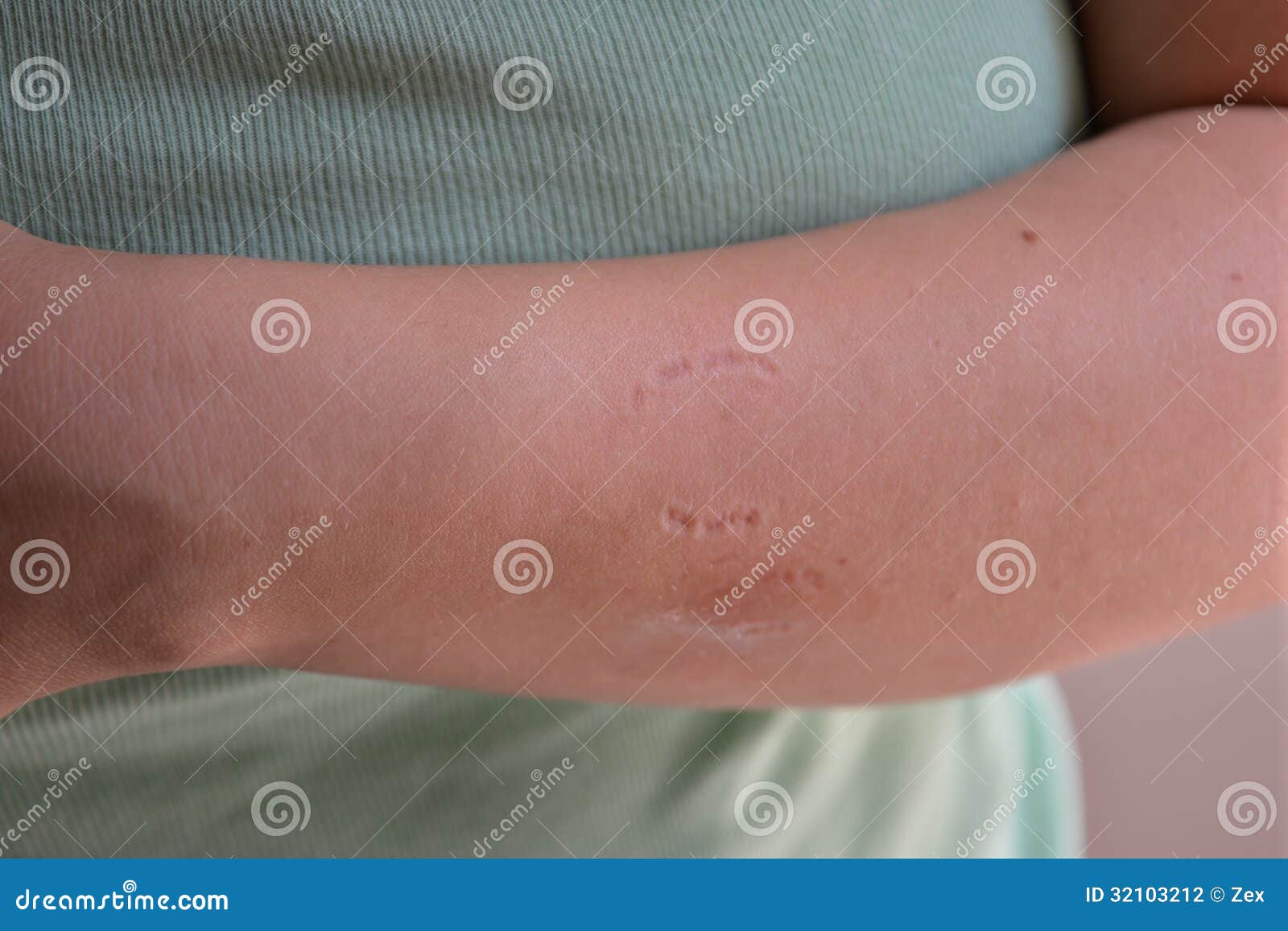 Children bite stock photo. Image of closeup, kids, fresh - 32103212