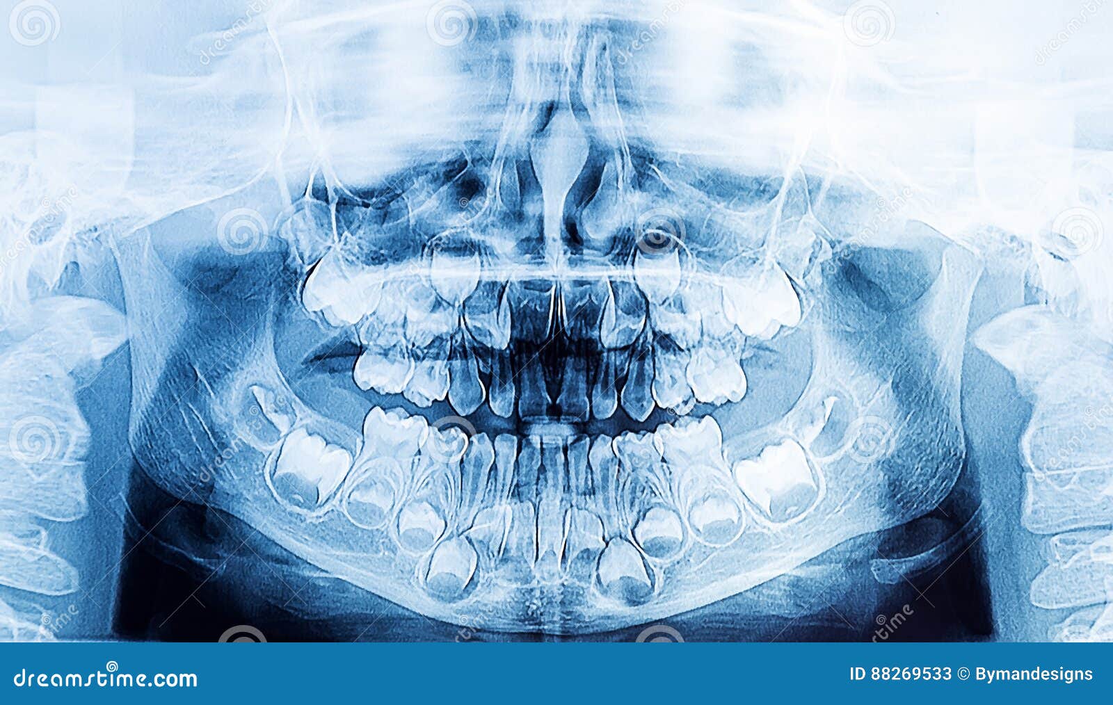Teeth Sample For Dental Study On Table Stock Photo | CartoonDealer.com ...