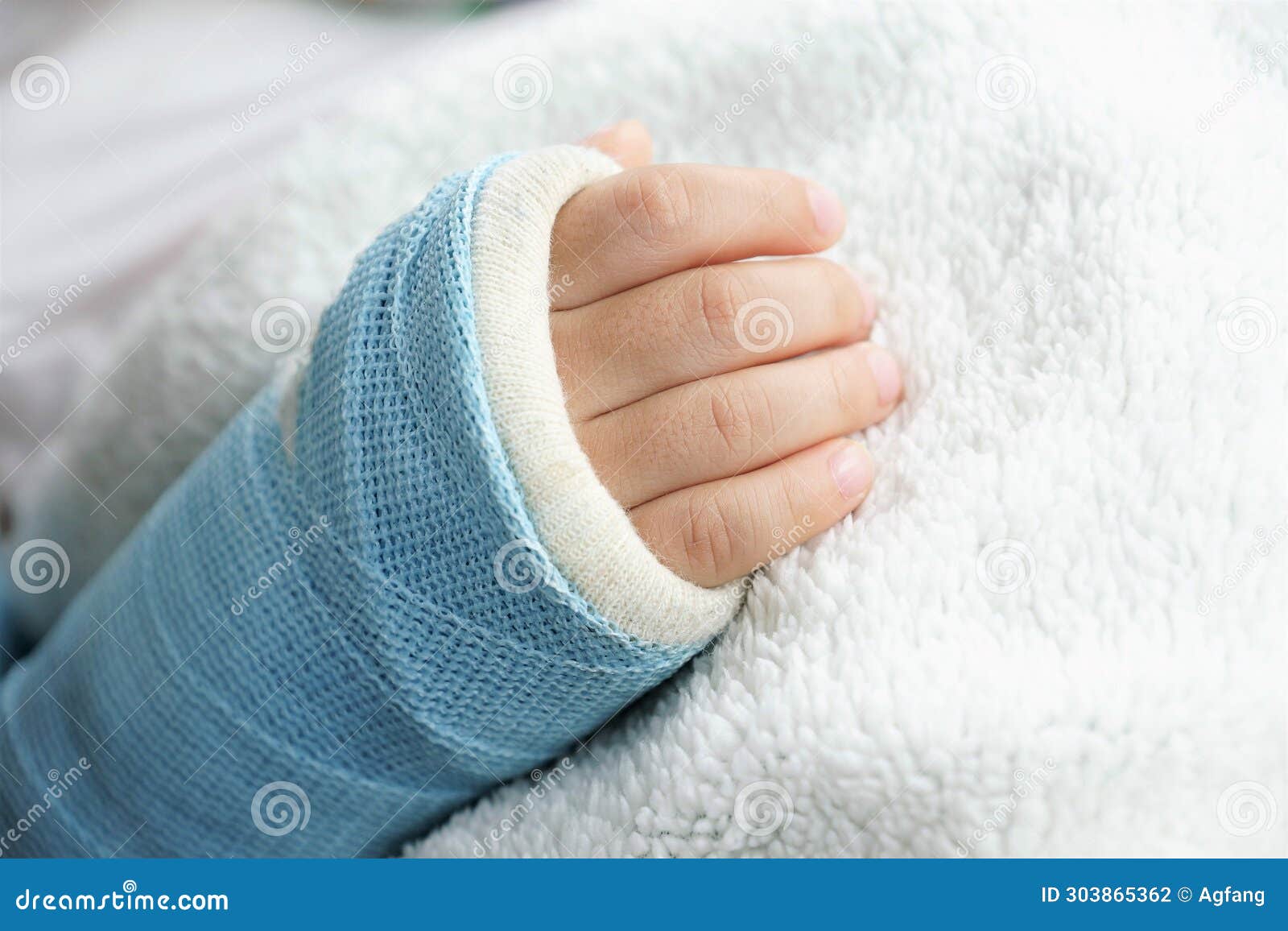 Children Hand Bone Broken with Arm Splint Stock Illustration ...