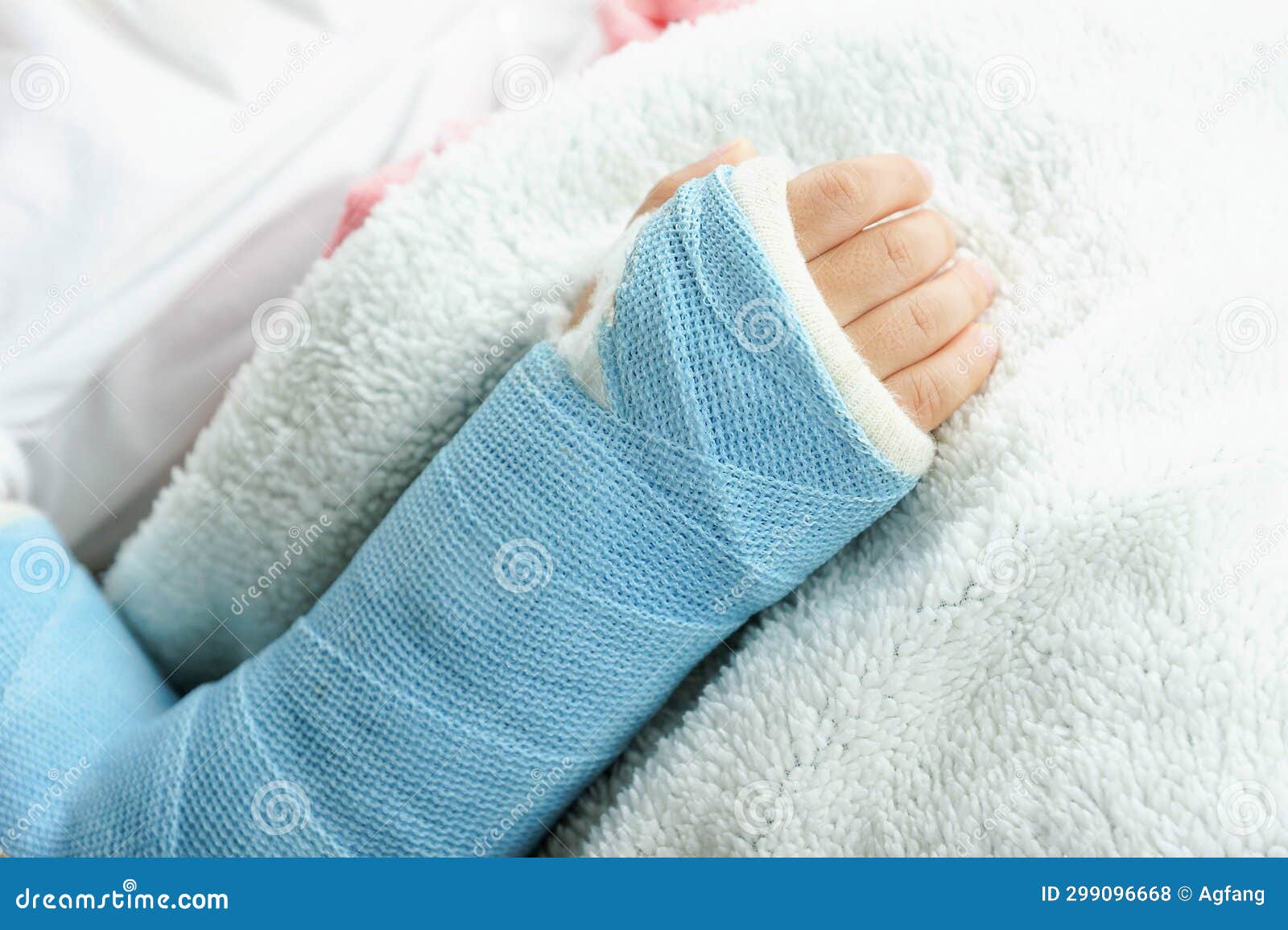 Children hand bone broken stock photo. Image of injury - 299096668