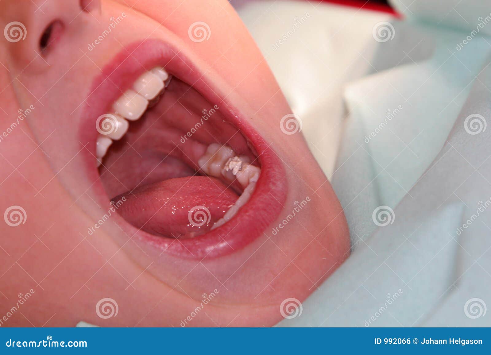 Children teeth stock photo. Image of mouth, health, open - 992066