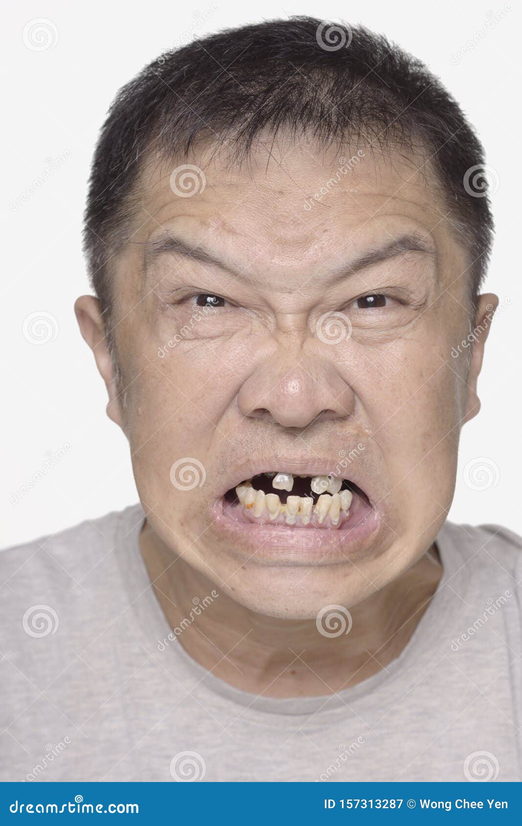 Chino Enojado Con Retrato De Dientes Malos Imagen de archivo - Imagen ...