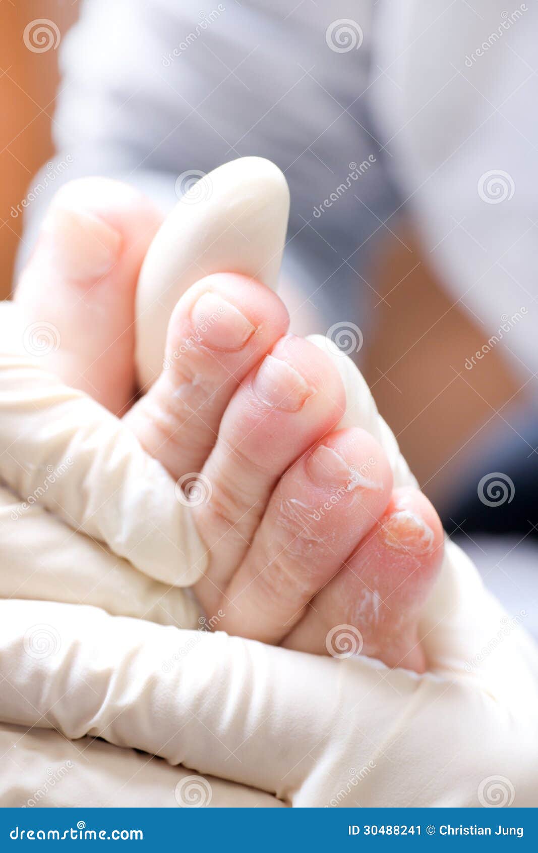 Chiropody stock image. Image of service, health, peeling - 30488241