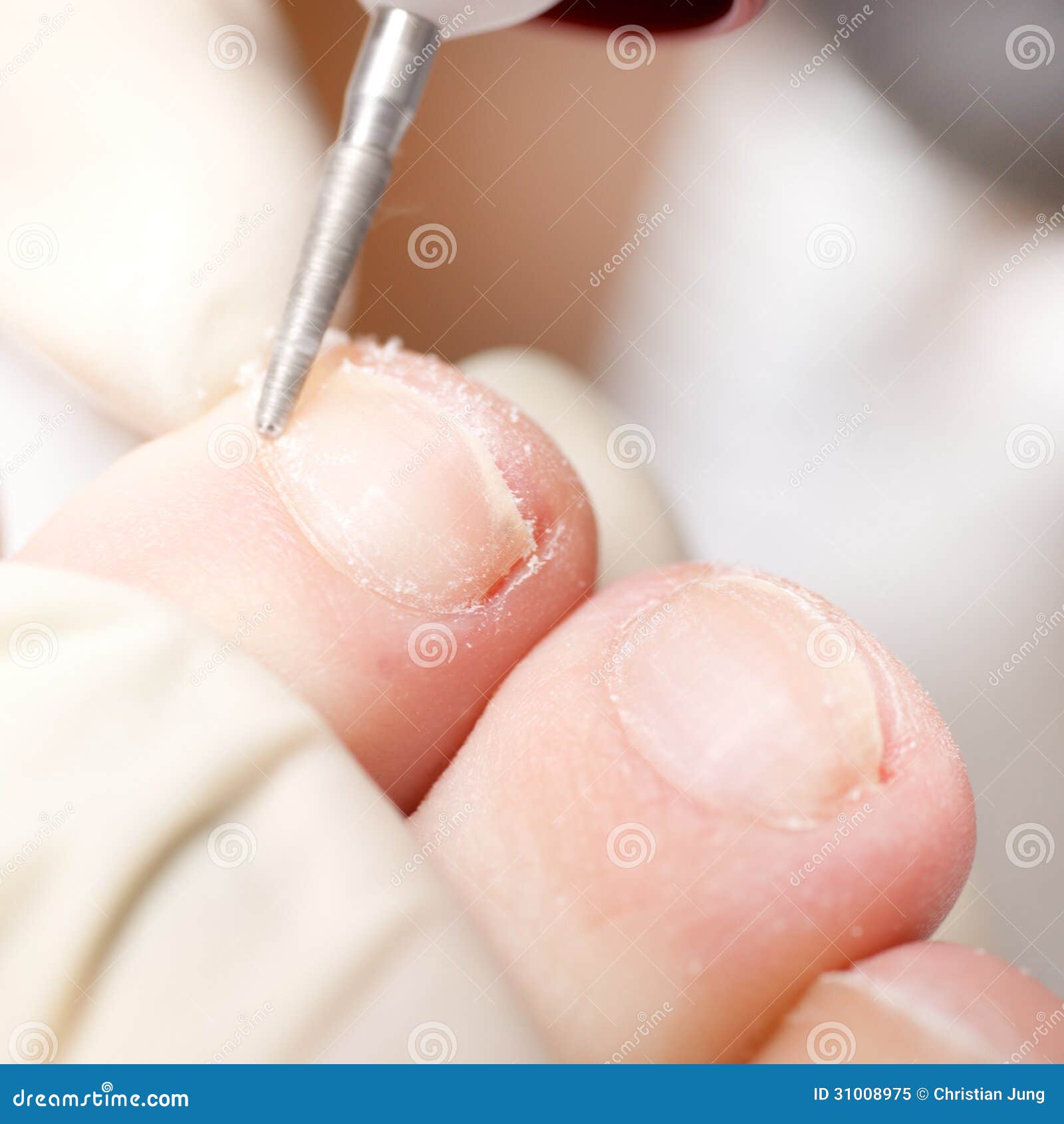 Chiropody stock image. Image of body, chiropody, pedicure - 31008975