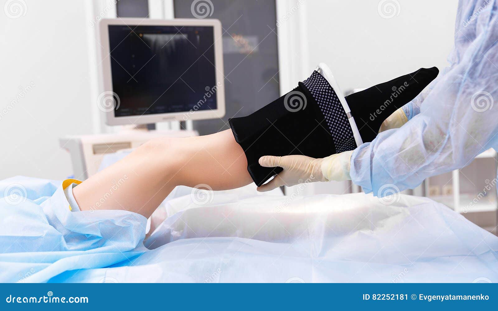 Chirurgie Van Spataders Compressiekousen Stock Afbeelding - Image of ...