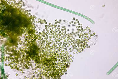Chlorella Under the Microscope in Lab. Stock Photo - Image of bloom ...