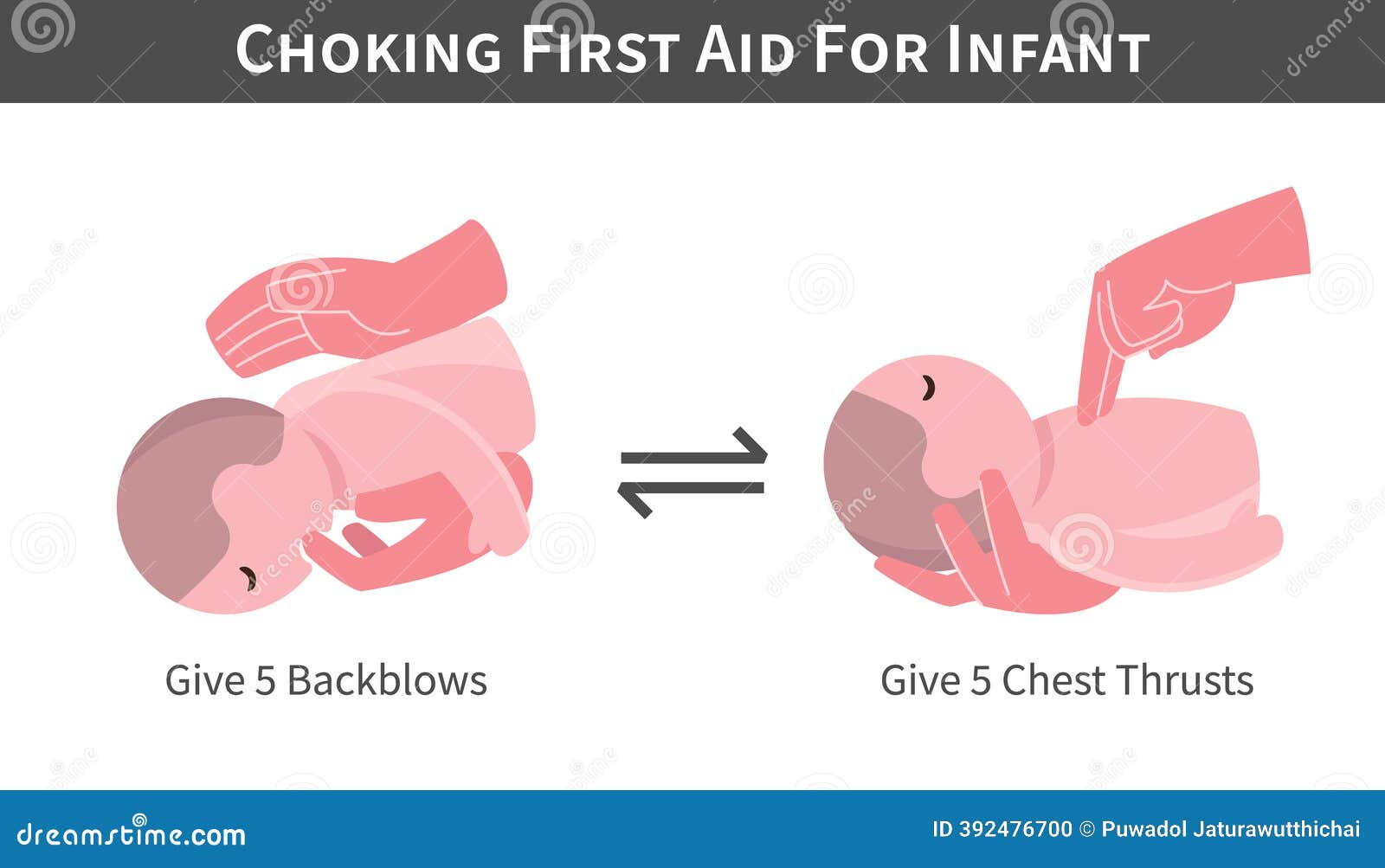 Choking First Aid. Heimlich Maneuver Procedure To Remove A Foreign ...