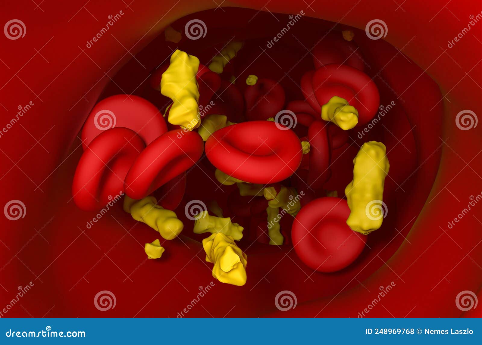 Phase Transition Mechanism In Phospholipids Of Plasma Membrane At ... Phase Transition Mechanism In Phospholipids Of Plasma Membrane At ...