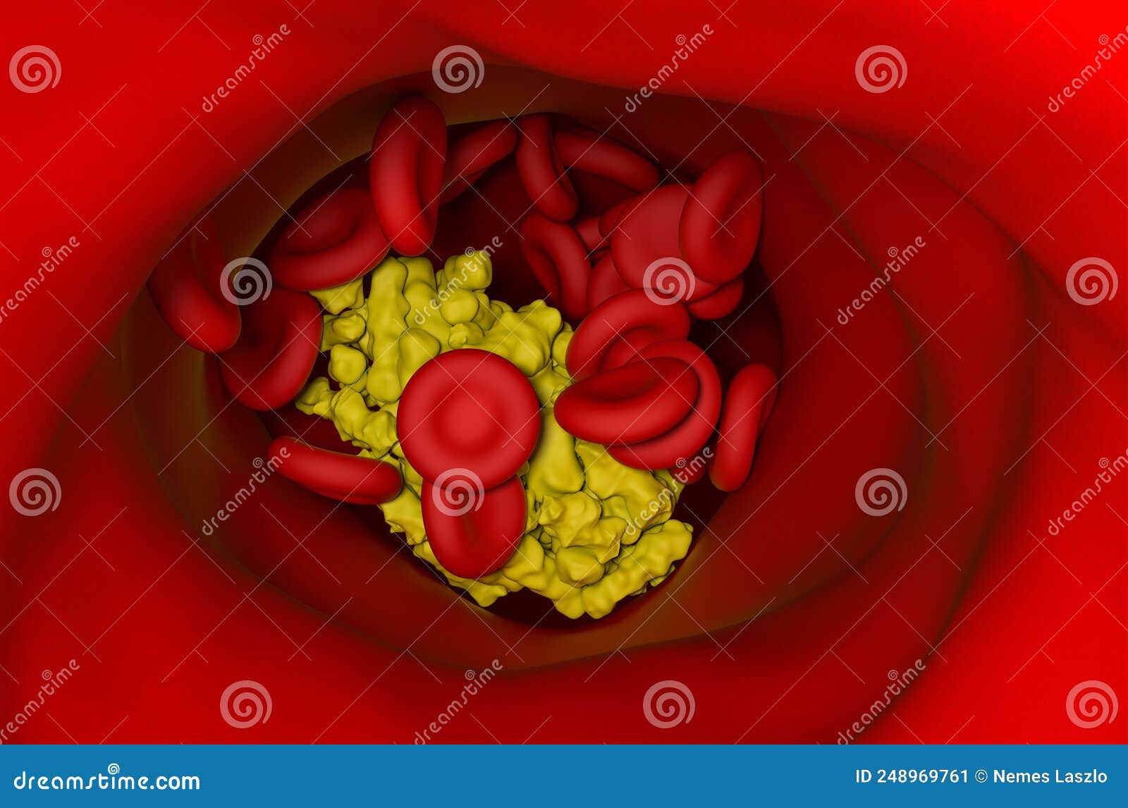 Phase Transition Mechanism In Phospholipids Of Plasma Membrane At ... Phase Transition Mechanism In Phospholipids Of Plasma Membrane At ...