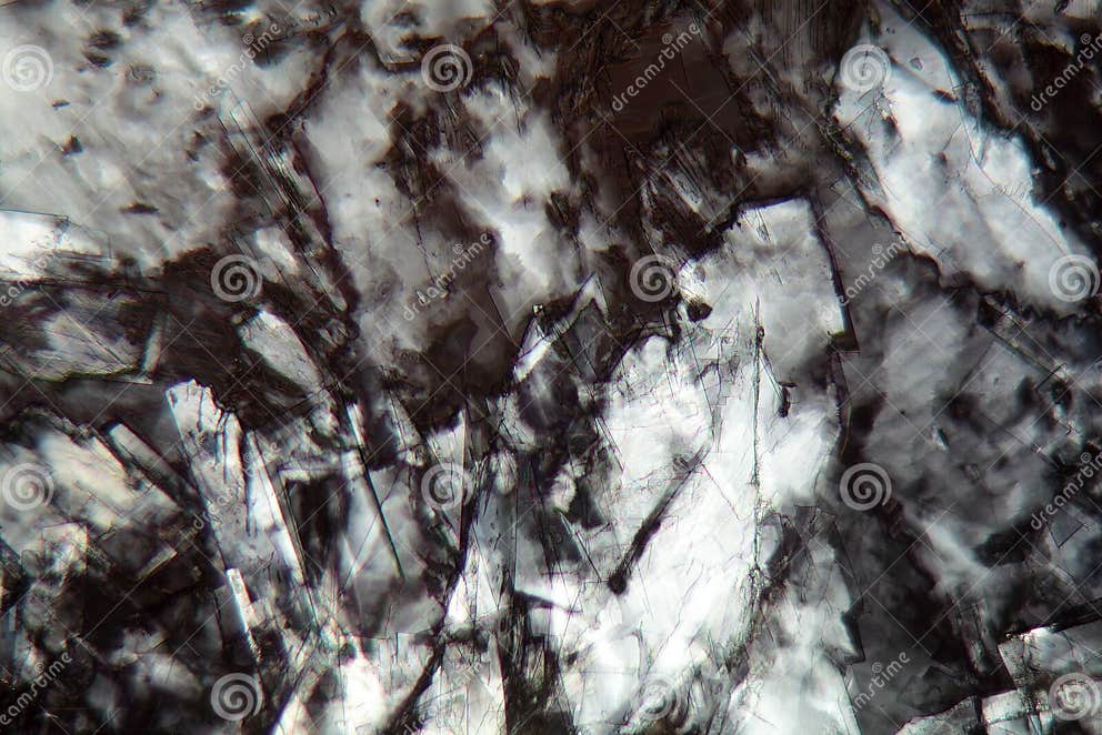 Cholesterol Crystals Under a Microscope Stock Photo - Image of artery ...