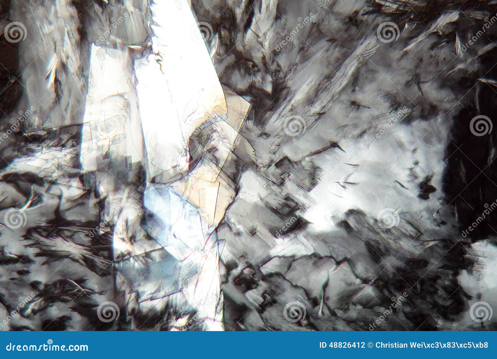 Cholesterol Crystals Under a Microscope Stock Photo - Image of ...