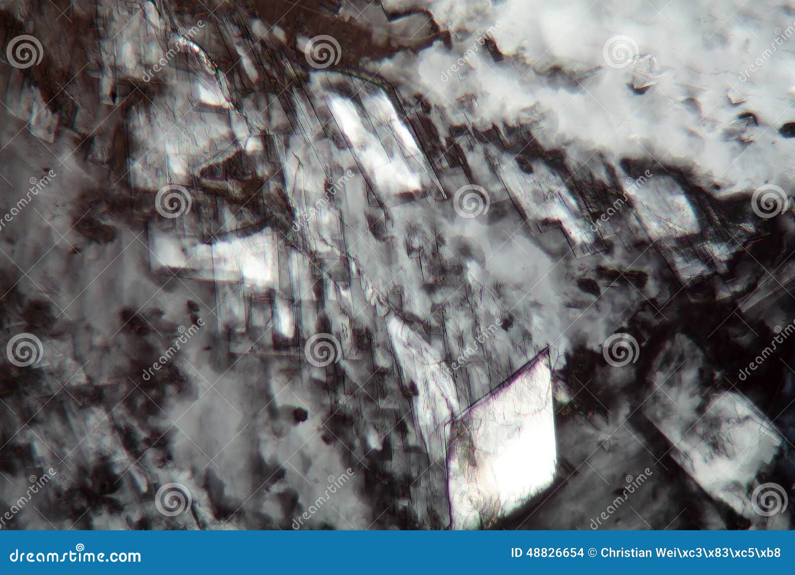 Cholesterol Crystals Under A Microscope Royalty-Free Stock Image ...