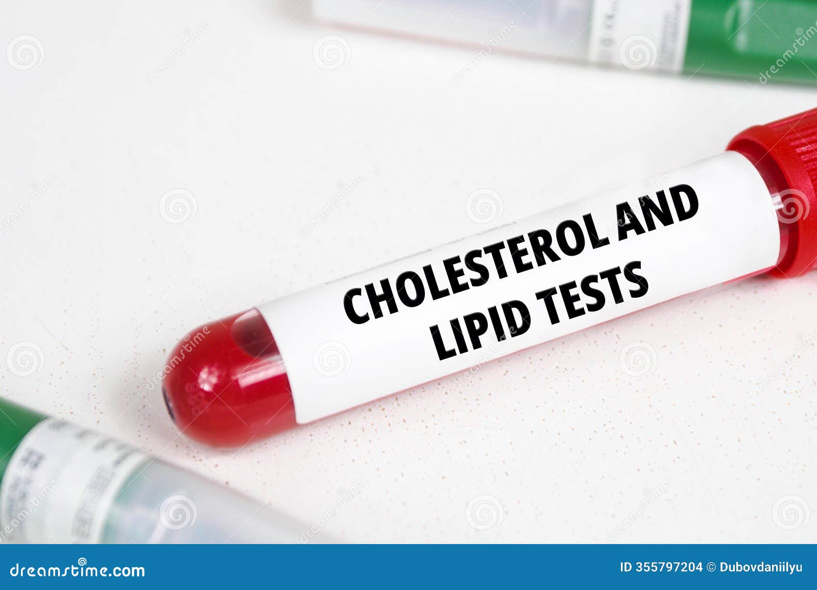 Cholesterol and Lipid Tests Title Text of Medical Analysis Stock Photo ...