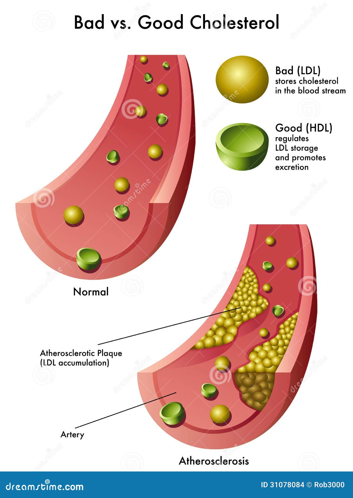 Cholesterol stock vector. Illustration of nutrition, cholesterol - 31078084