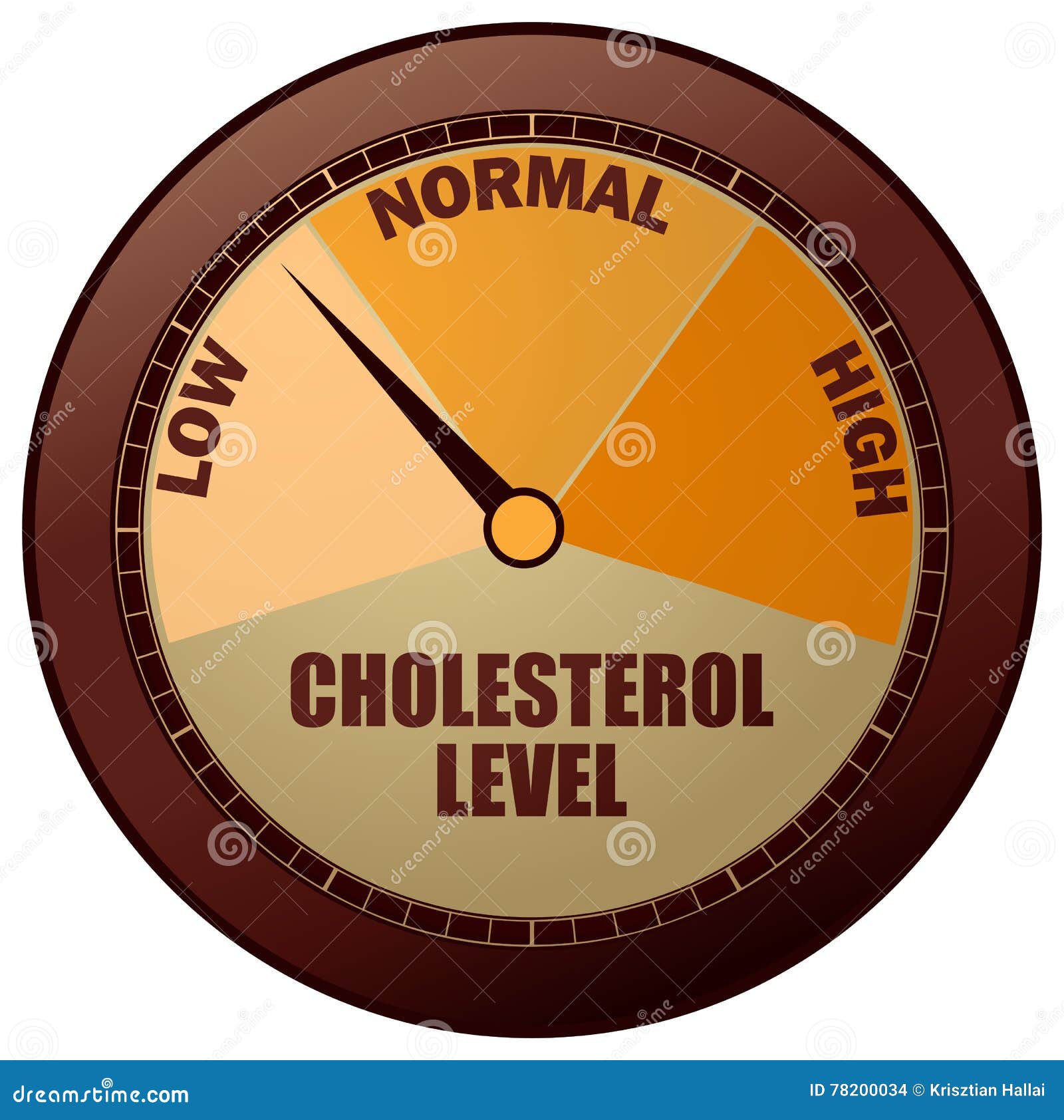 Cholesterol Meter Vertical Scale. Atherosclerosis, Hyperlipidemia ...