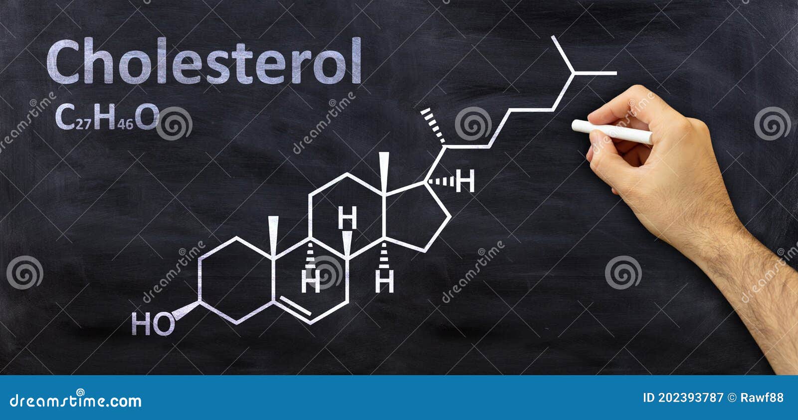 Cholesterol Structural Chemical Formula, Chalk Drawing on a Blackboard ...