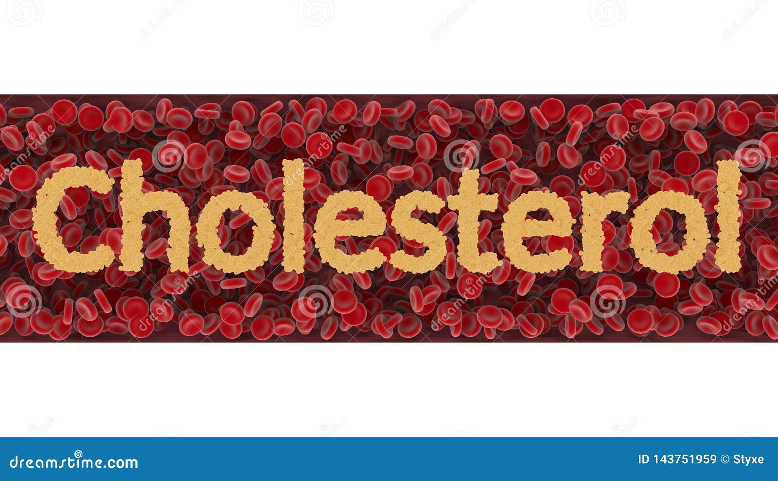 Cholesterol Yellow Cells with Blood Red Cells in Vein. Stock ...