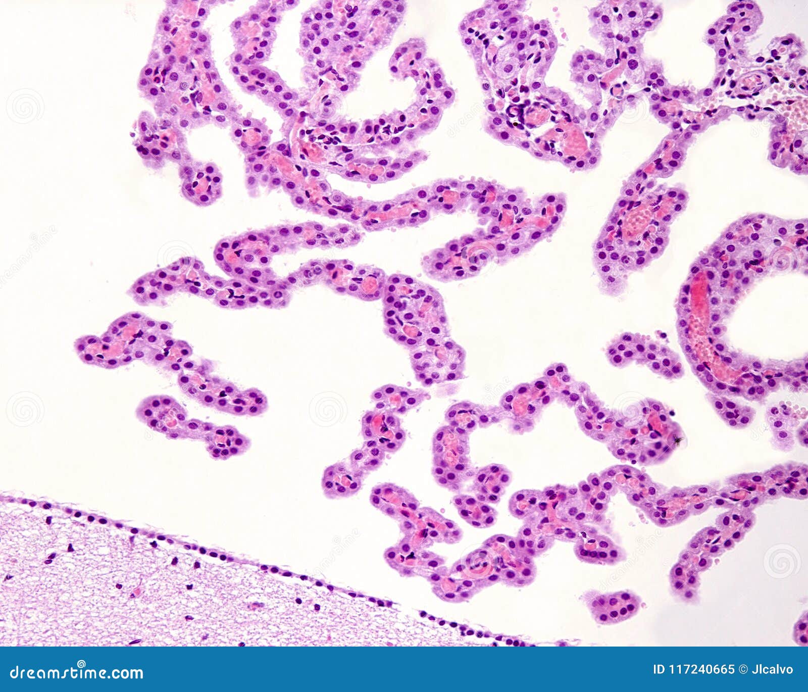 Choroid plexus stock image. Image of epithelium, neuroimaging - 117240665