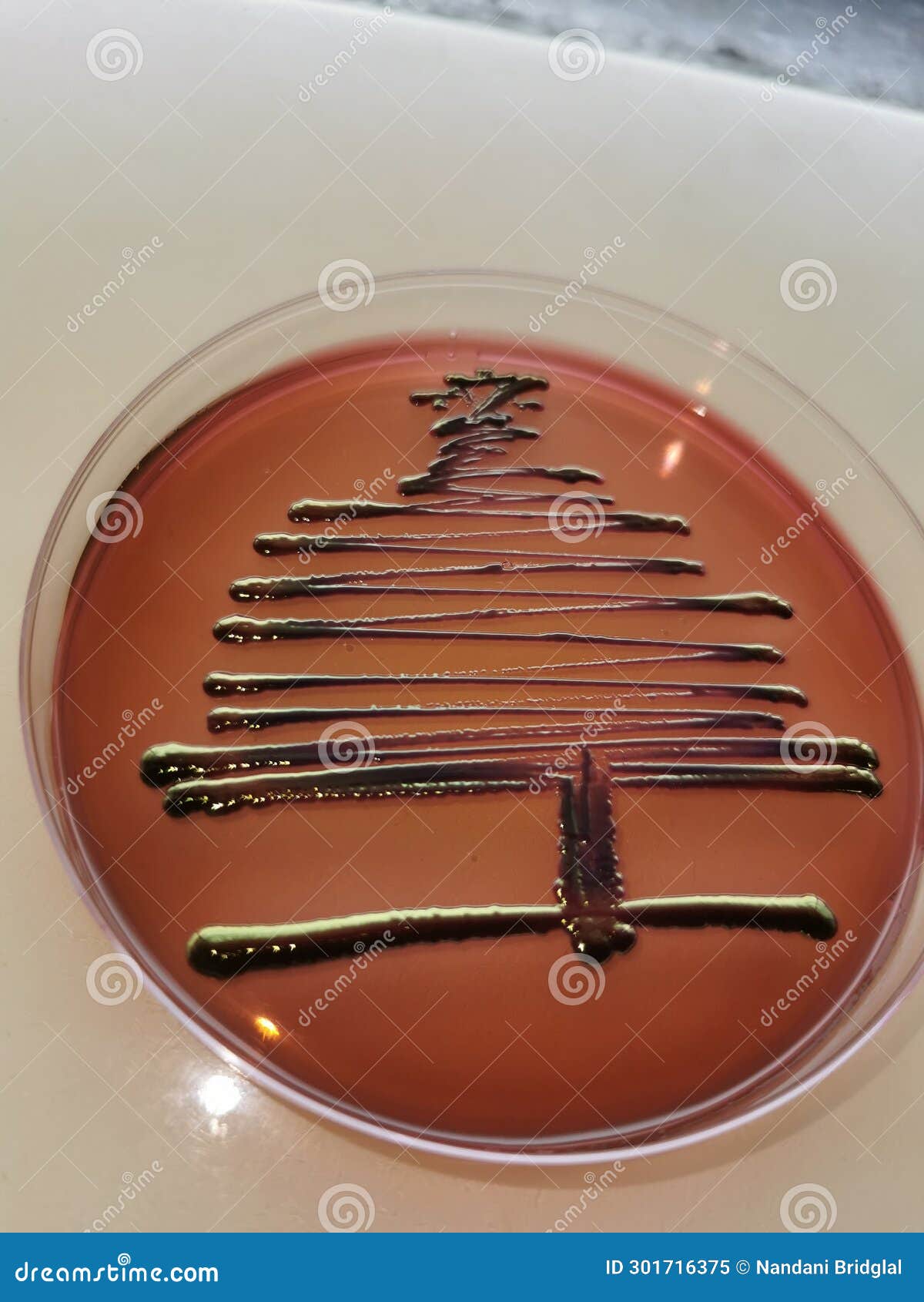 Christmas Tree Pattern of Escherichia Coli Stock Image - Image of ...