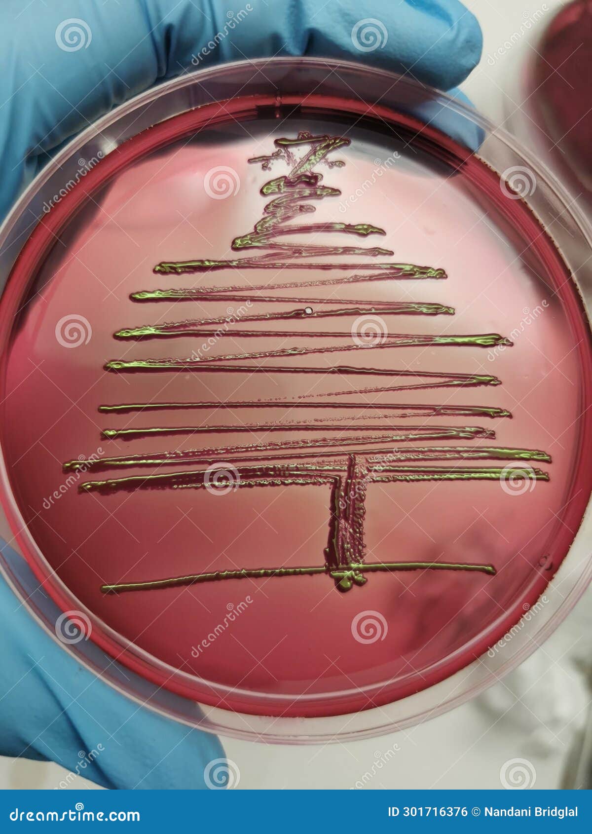 Christmas Tree Pattern of Escherichia Coli Stock Photo - Image of ...