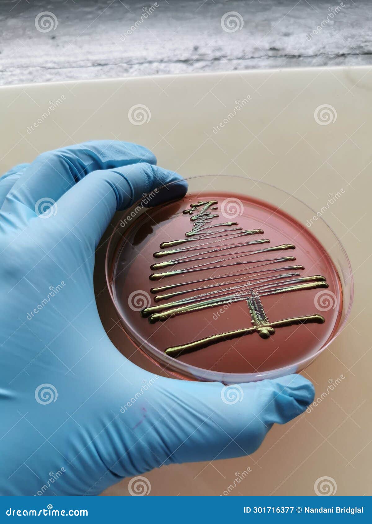 Christmas Tree Pattern of Escherichia Coli Stock Image - Image of ...