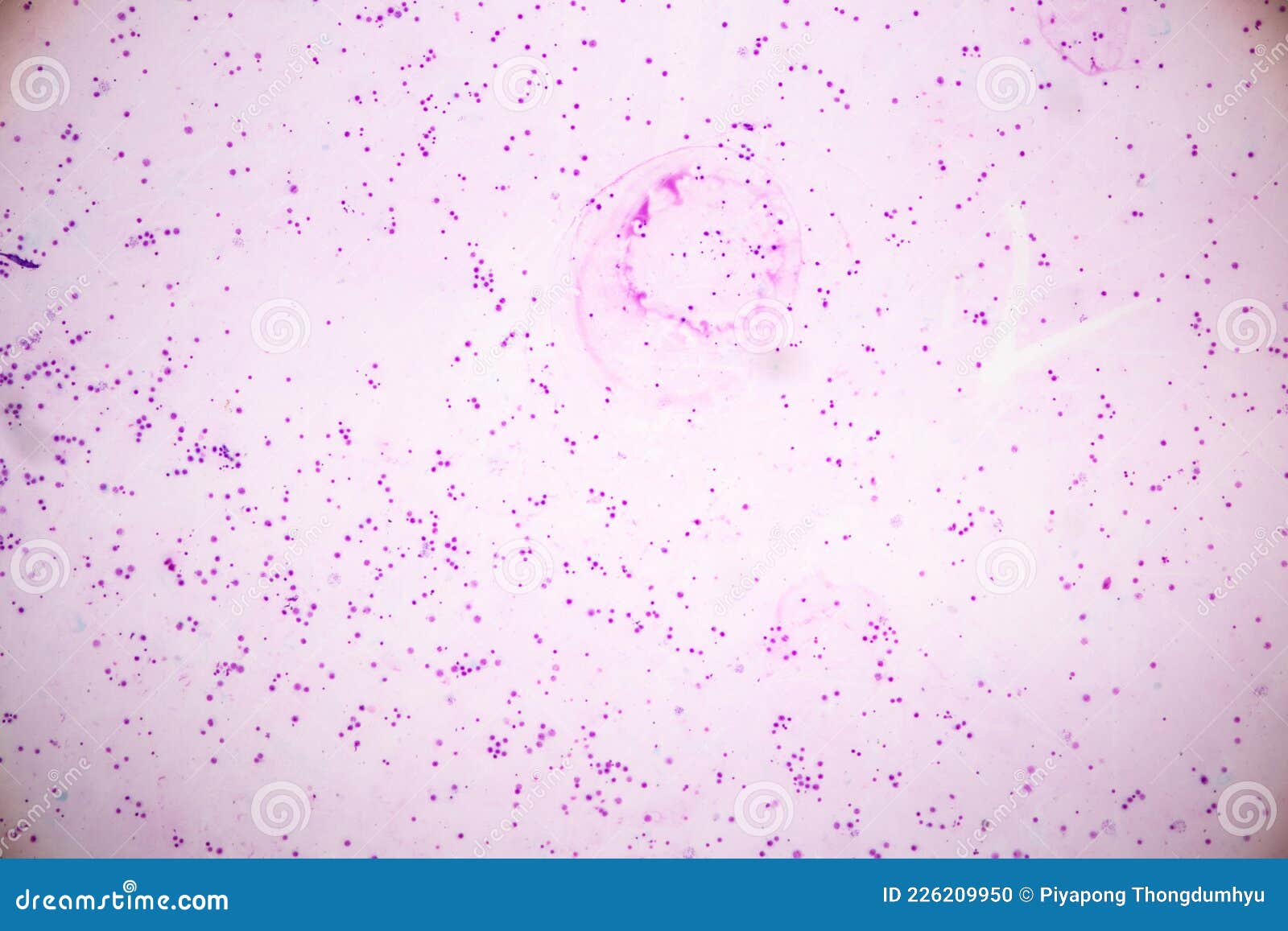 Chromosomes Humains Au Microscope. Photo stock - Image du microscopique ...