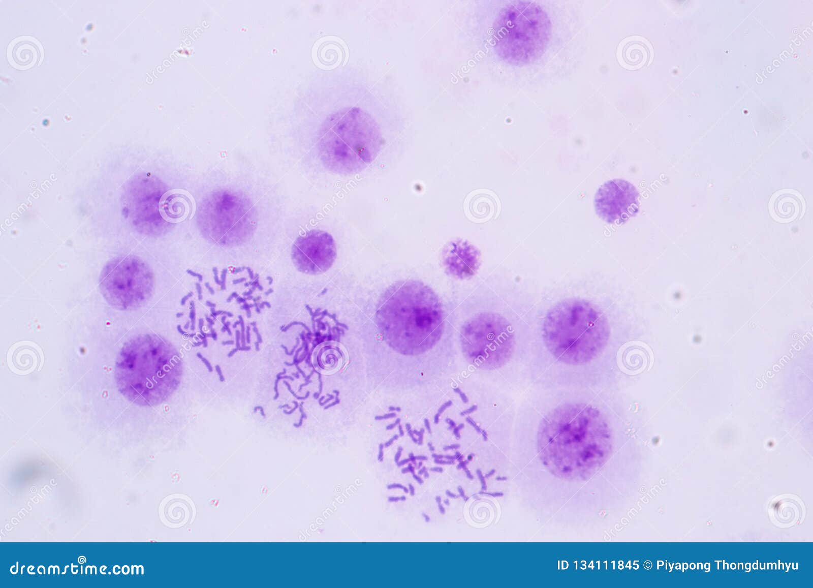 Chromosomes Humains Sous Le Microscope Pour L'éducation Image stock ...