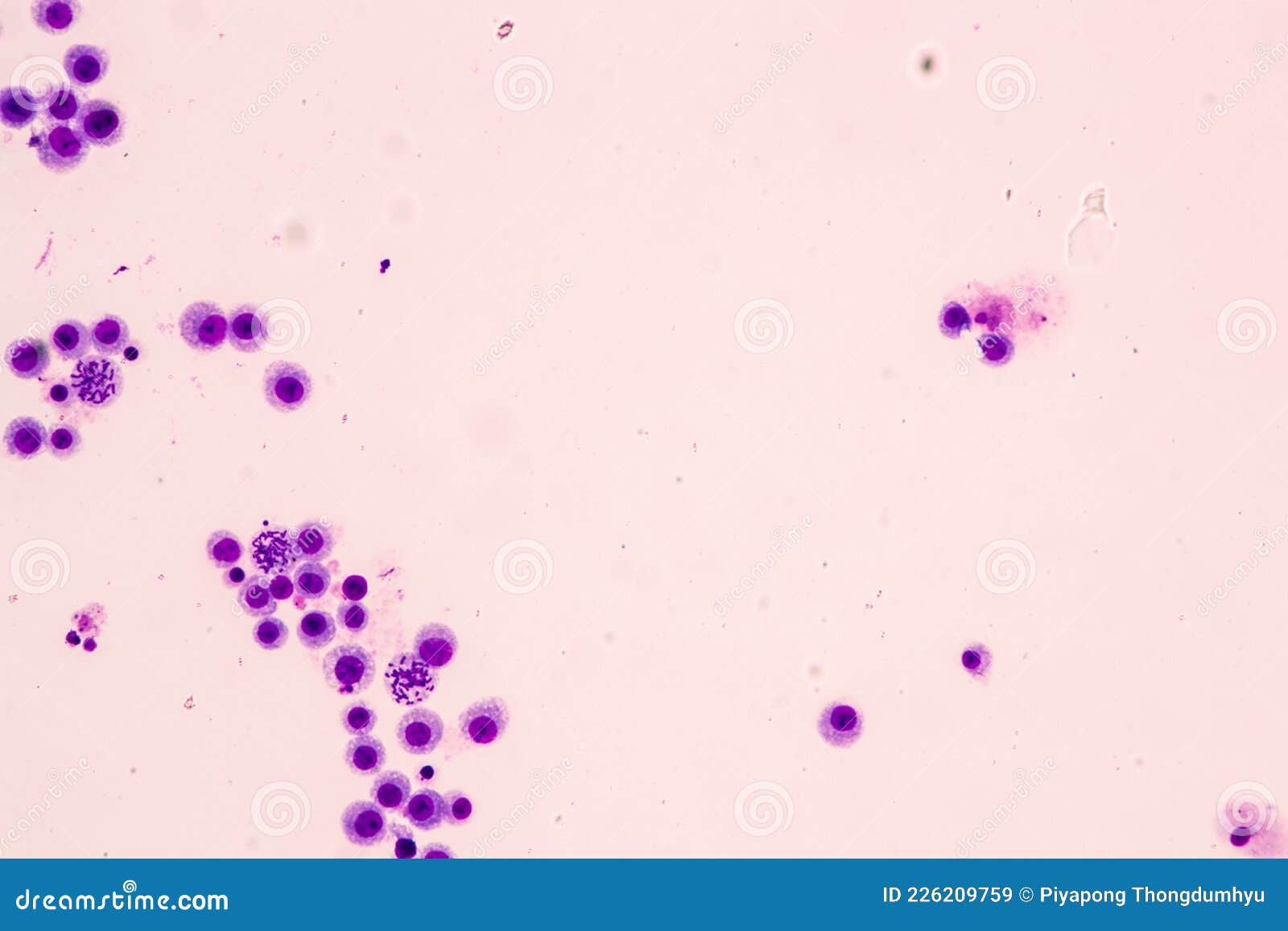 Chromosomes Human Under the Microscope. Stock Image - Image of genetic ...