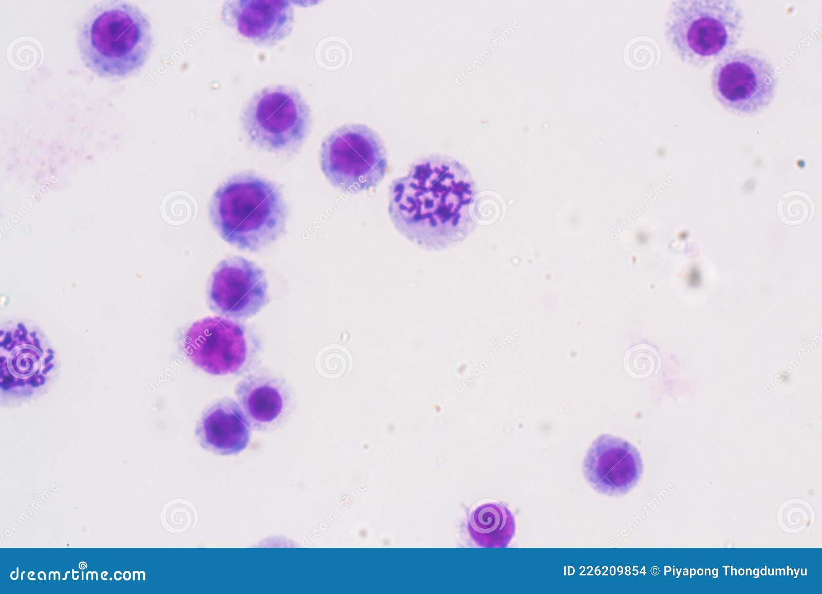 Chromosomes Human Under the Microscope. Stock Photo - Image of ...