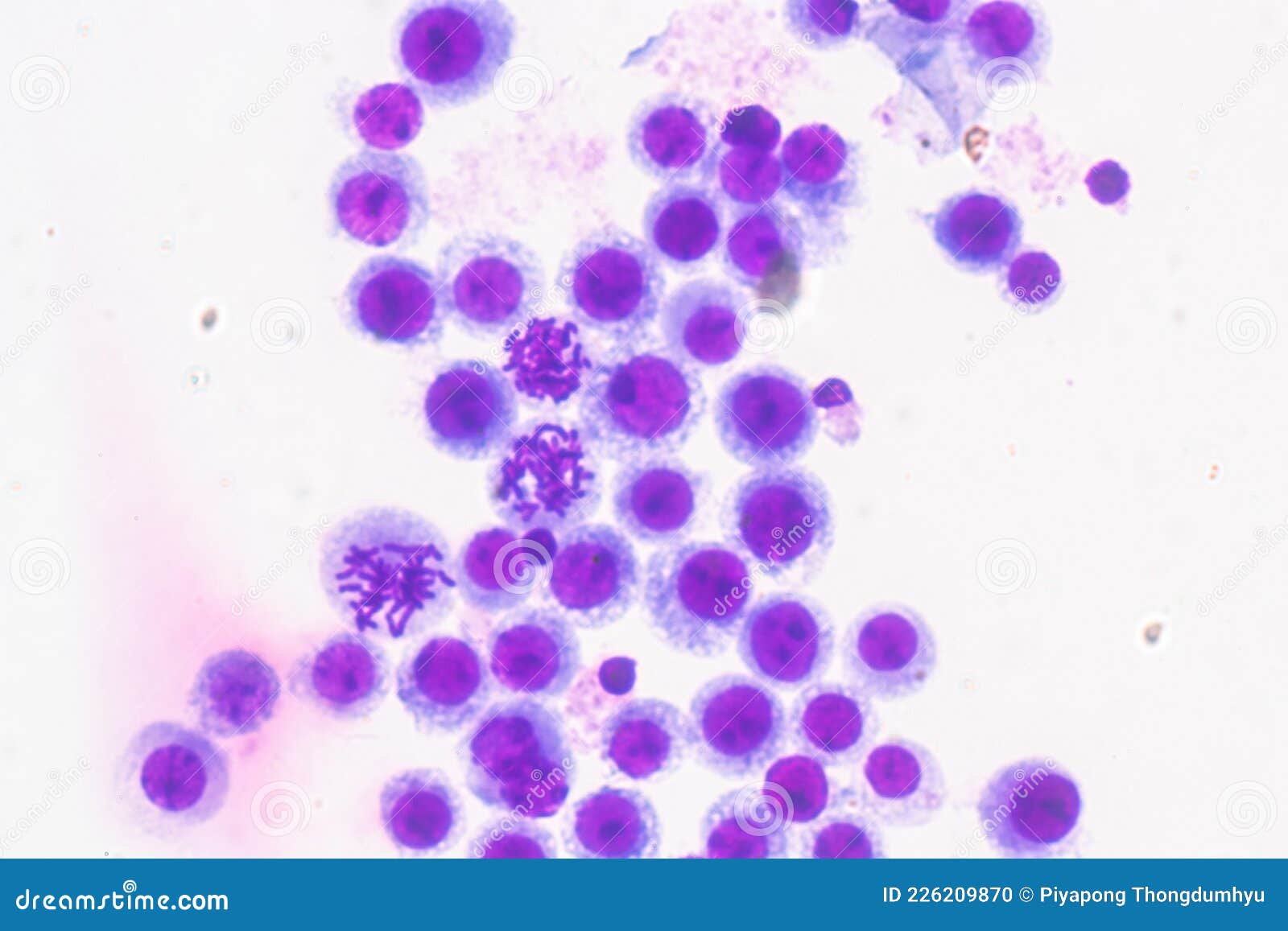 Chromosomes Human Under the Microscope. Stock Photo - Image of ...