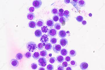 Chromosomes Human Under the Microscope. Stock Photo - Image of ...